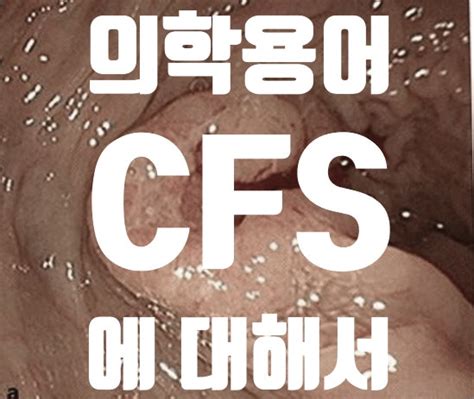 의학용어 Cfs에 대해서 알아보고 시술 전 간호에 대해서 알아봐요~ 네이버 블로그