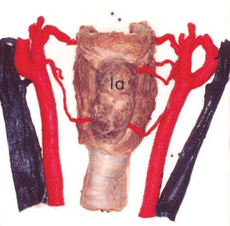 Median Thyroid Tissue Download Scientific Diagram