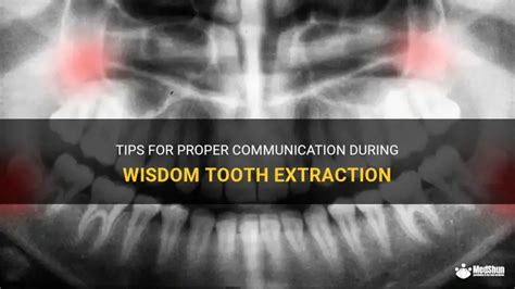 Tips For Proper Communication During Wisdom Tooth Extraction Medshun