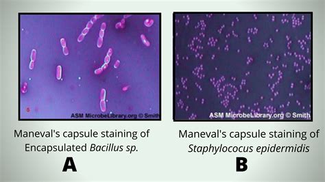 Capsule Stain Differential Staining Techniques Microbiology A