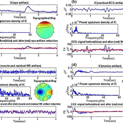Eeg Signals Obtained After Bcg Artifact Removal Using Ica And Hermite Download Scientific