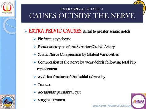 Extra Spinal Causes Of Sciatica And A Causes Algorithm Ppt