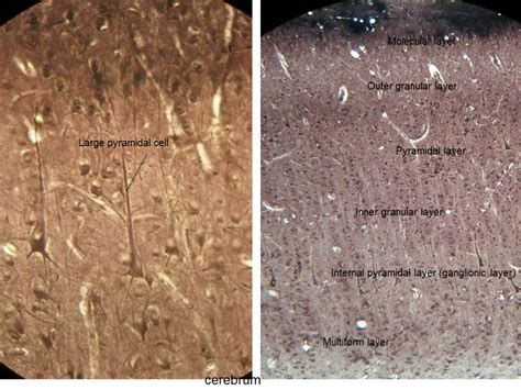 Outer Granular Layer Cerebral Cortex Funicular Layercerebrum Internal