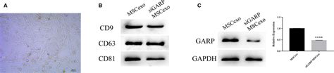 Extraction And Identification Of Exosomes From Mscs And Sigarp‐mscs A