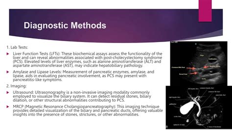 Post Cholecystectomy Syndrome And Chronic Cholelithiasispptx