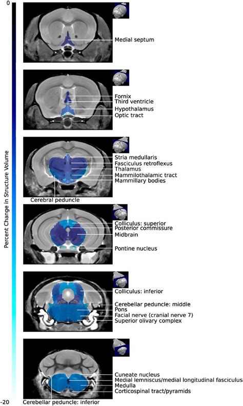 Aged Hind Limb Clasping Experimental Autoimmune Encephalomyelitis Models Aspects Of The