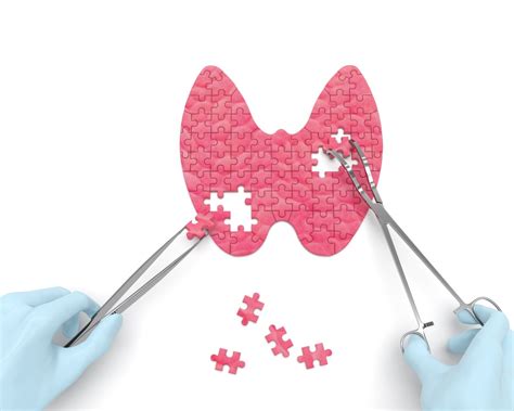 Parathyroidectomy Reduces Death Cardiovascular Events Risks In