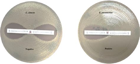 Ampc Mic Test Strip Detection Of Ampc Producing Gnb By The Combined Download Scientific