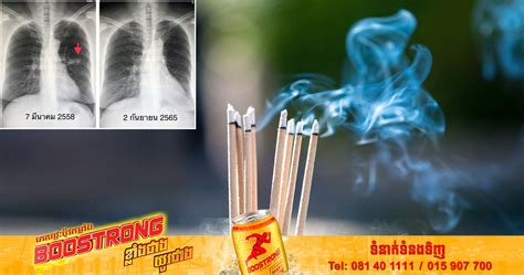 បងប្អូនដែលឧស្សាហ៍អុជធូបគួរតែប្រយ័ត្ន ស្ត្រីជនជាតិថៃម្នាក់រកឃើញថា ខ្លួនកើតជំងឺមហារីកសួត