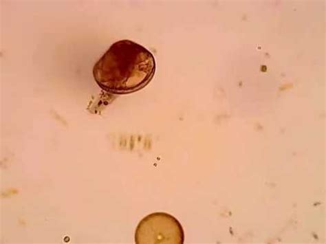 二枚貝類の有足ベリジャー幼生Veliger larva YouTube