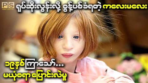 ရုပ်ဆိုးလွန်းလို့ မိဘတွေ စွန့်ပစ်ခြင်းခံရတဲ့ မိန်းကလေးရဲ့ မယုံနိူင်ဖွယ