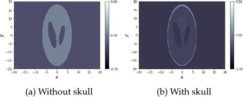 Figure 11 From Reconstruction Approach For Partially Truncated Ct Data Semantic Scholar