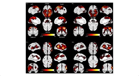Dorsal And Ventral Attention Networks Dorsal Attention Network In A Download Scientific