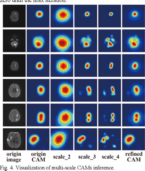 Mixed Unet Refined Class Activation Mapping For Weakly Supervised