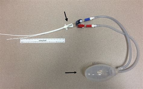 Hybrid Closed Loop Catheter System Table Mock Up Dual Channel Download Scientific Diagram