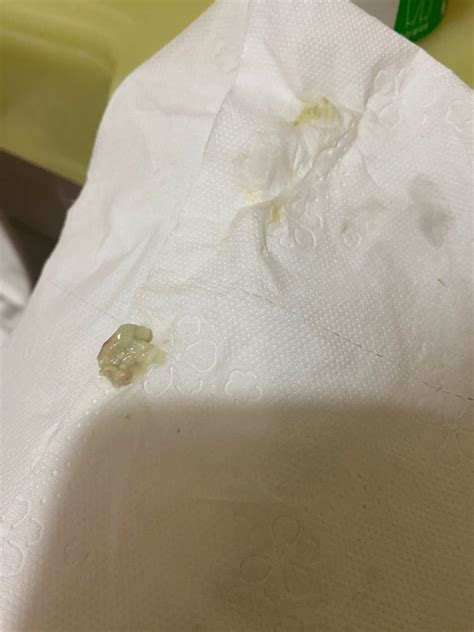 녹색 덩어리 냉 뭐죠사진 있음 지식in