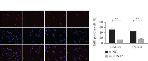 Runx2 Knockdown Inhibited Malignant Progression Of Bladder Cells A