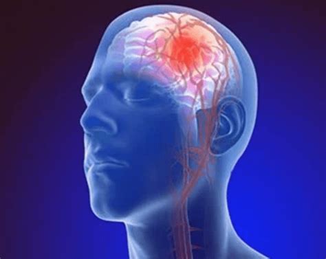 Stroke Prediction With Machine Learning