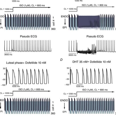 Sex Based Differences In Human Cardiac Electrophysiology Predicted In Download Scientific