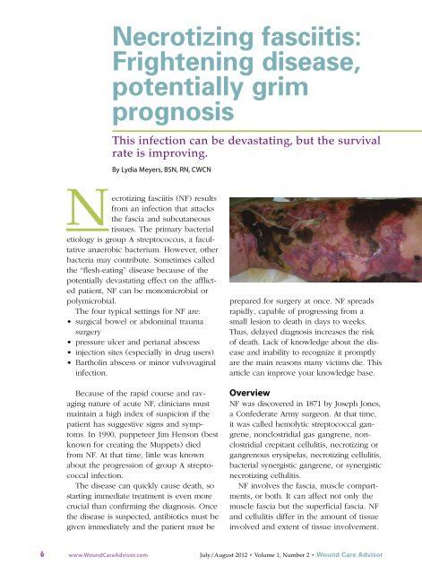 Necrotizing Fasciitis Progression