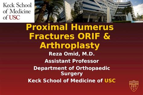 Ppt Proximal Humerus Fractures Orif And Arthroplasty Dokumen Tips