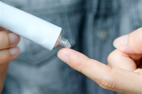 Eczema Psoriasis And Dermatitis Topical Steroids And Their Side Effec Honey Biotics
