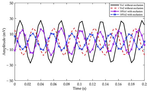 Comparison Of The Experimental Waveforms With And Without Occlusion