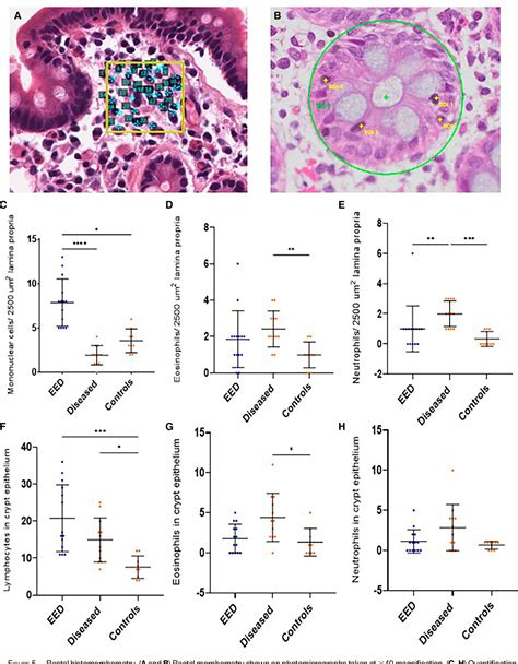 Figure 1 From Quantitative Morphometry And Machine Learning Model To Explore Duodenal And Rectal