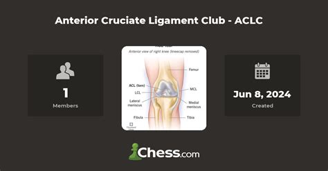 Anterior Cruciate Ligament Club Aclc Chess Club