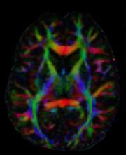 Python How To Plot Data Using Oriented Coloring In Matplotlib Stack Overflow
