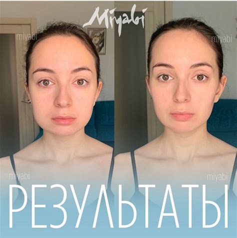 Асимметрия лица 79 фото