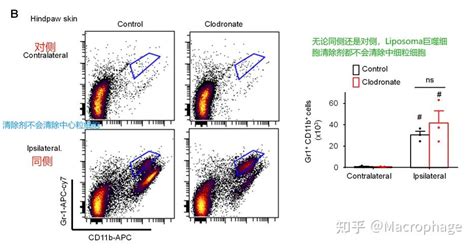 中心粒细胞会被巨噬细胞清除剂clodronate Liposomes清除吗？ 知乎