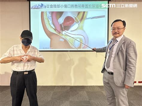 攝護腺癌康復卻漏尿！醫施懸吊手術治好他 鏡週刊 Mirror Media