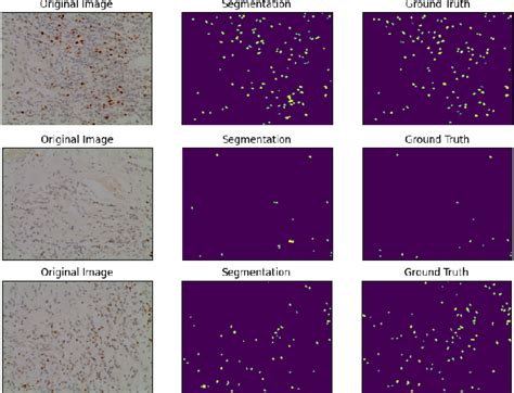Figure 1 From Single Shot Object Detection And Supervised Image Segmentation For Analysing Cell