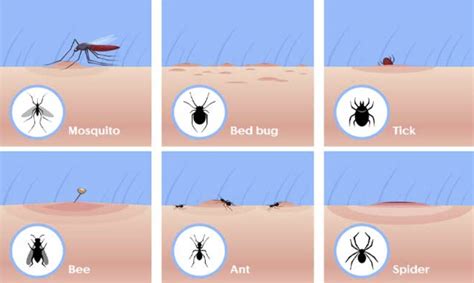 What Do Bed Bug Bites Look Like Thermopest Bed Bug Control