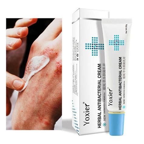 Yoxier Herbal Antibacterial Cream Psoriasis Cream Anti Itch Relief Eczema Skin Rash Urticaria