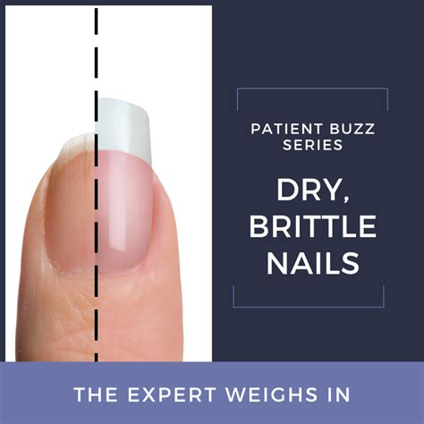 Brittle Splitting Fingernails At Kasey Bailey Blog