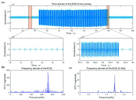 A Ecg Polluted By The Gradient Artifact In The Time Domain The More