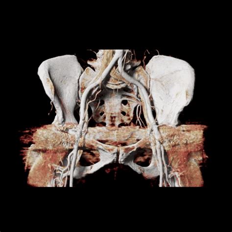 Metal Artifact Reduction 3d And Quantitative Imaging Laboratory