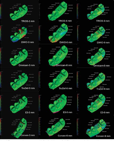 Figure 1 From Different Implant Subgingival Depth Affects The Trueness And Precision Of The 3d