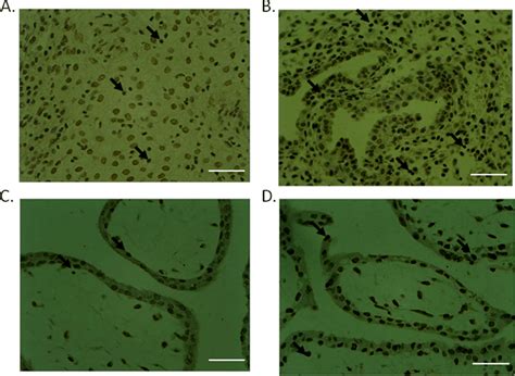 Tunel Staining Of Apoptotic Cells In Decidua Tissues A B And Download Scientific Diagram