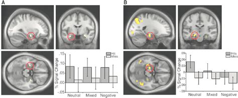 Encoding Activity Showing Subsequent Memory Effects Across Emotional Download Scientific