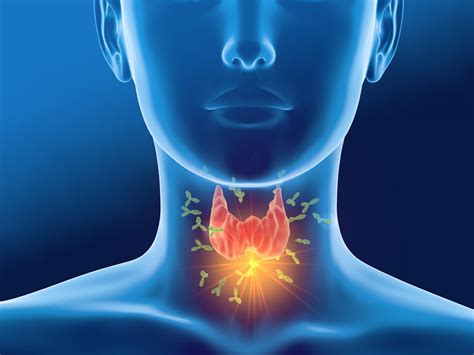 Reasons For Elevated Thyroid Antibodies At Kate Wardill Blog