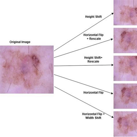 Proposed Framework And Data Pipeline For Comparative Study Of Gan Vs