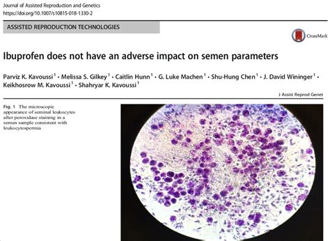 Dr Kavoussi Publishes Research Showing Ibuprofen Does Not Impact Mens