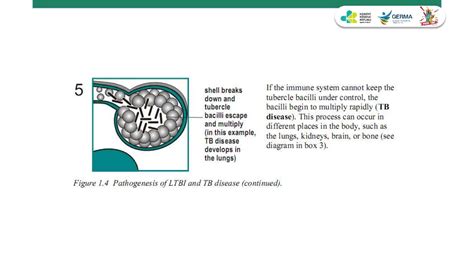Diagnosis TBC Pada Dewasa OK Pptx