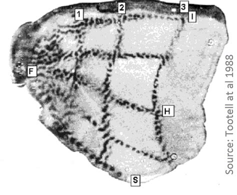 Experiment Of Totelli Retina With Spoke Wheel Stimulus Is