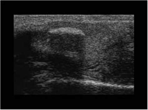 Urinary Tract And Male Reproductive System 24 Penis And Perineum