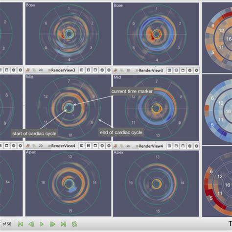 Coordinated Views Of Spatio Temporal Views Of Individual Slices 3 × 3 Download Scientific