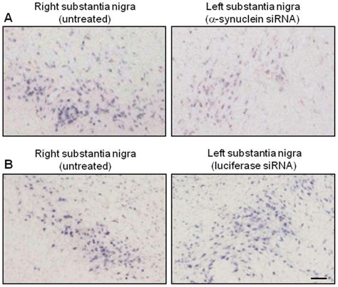 Substantia Nigra Histology